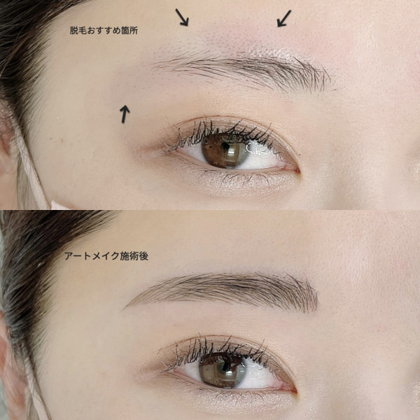 お知らせ | アートメイク(医療アートメイク矯正)Arub(アルブ)